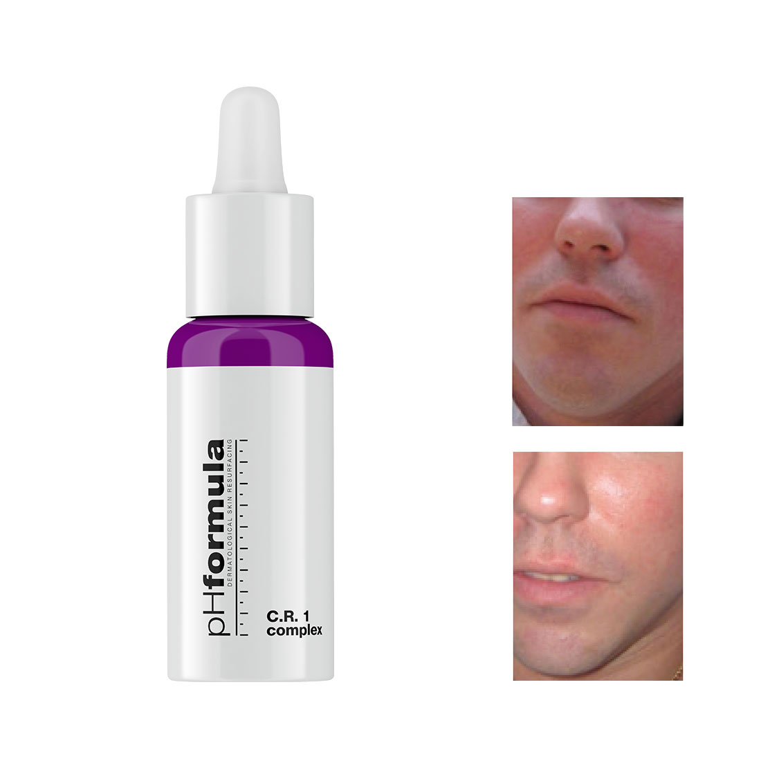 Complete restoration treatment – Thuy Duong